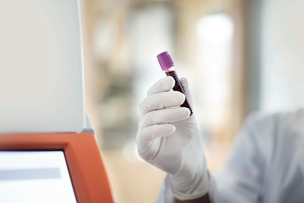 Sistema automatico T2Dx - DID